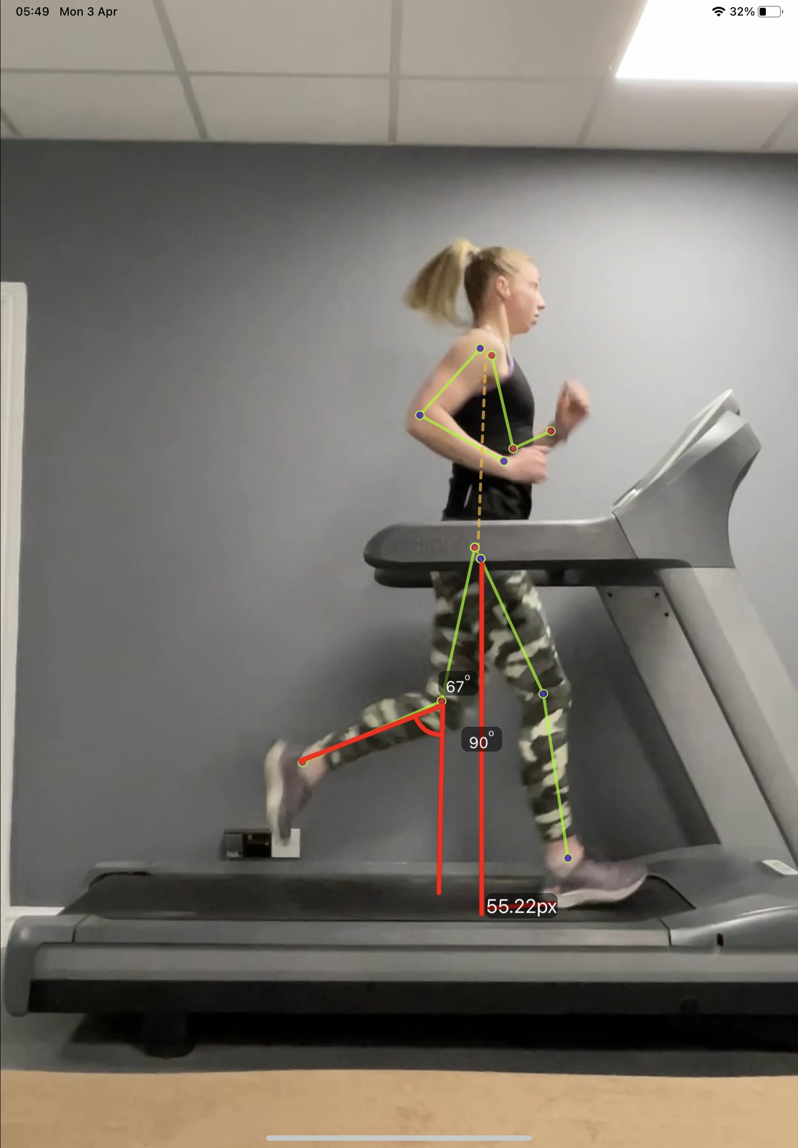 Movement Screening – Lincs Injury Clinic